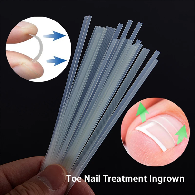 5pcs-Ingrown-Toenail-Correction-Tool-Ingrown-Toe-Nail-Treatment-Elastic ...