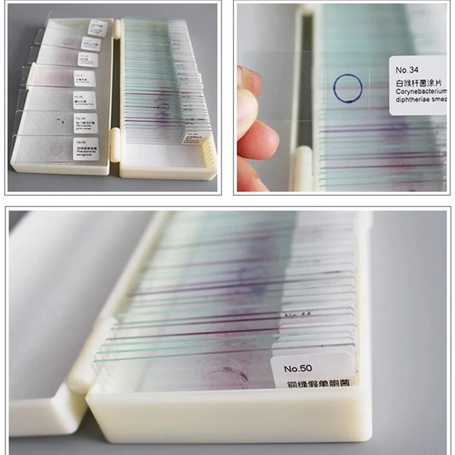 Yeast Fungi Slide