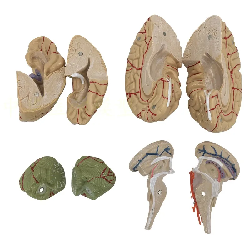 brain-anatomy-model-cerebral-hemisphere-brain-stem-ventricle ...