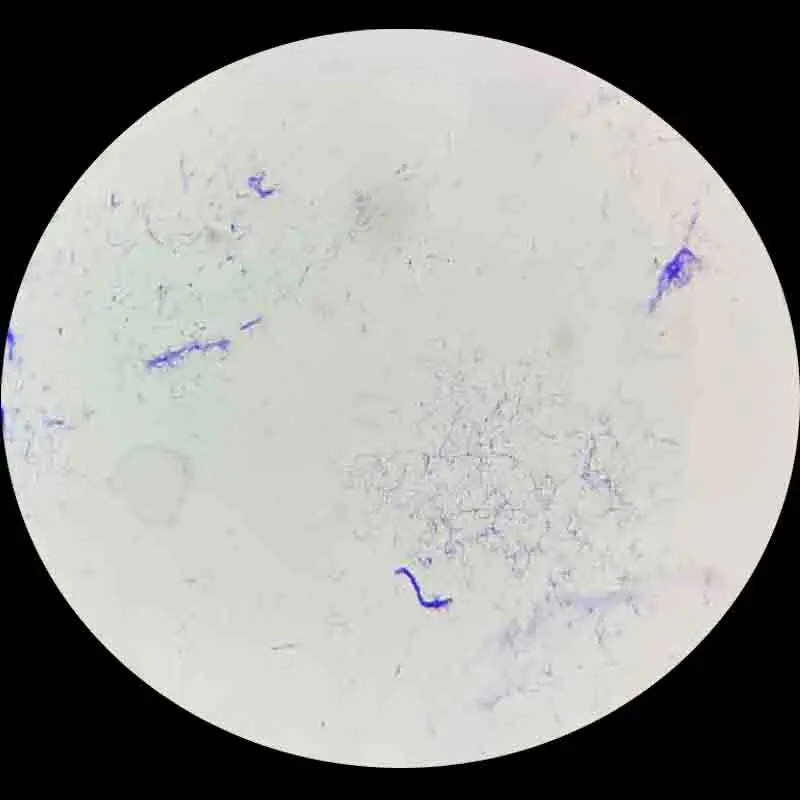 Bacteria Under Microscope 100x