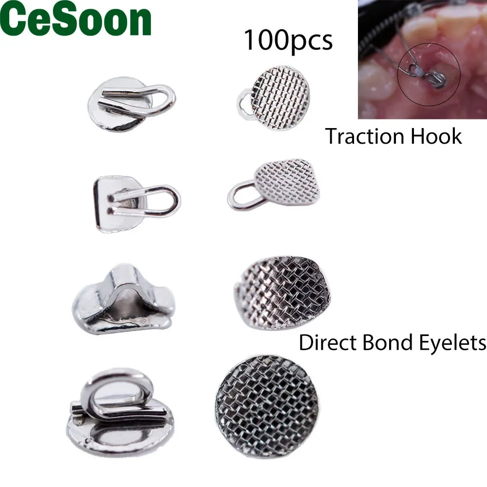 Dental-Orthodontic-Lingual-Buttons-Teeth-Corrector-Bondable-Crimpable-Direct-Bond-Eyelets ...