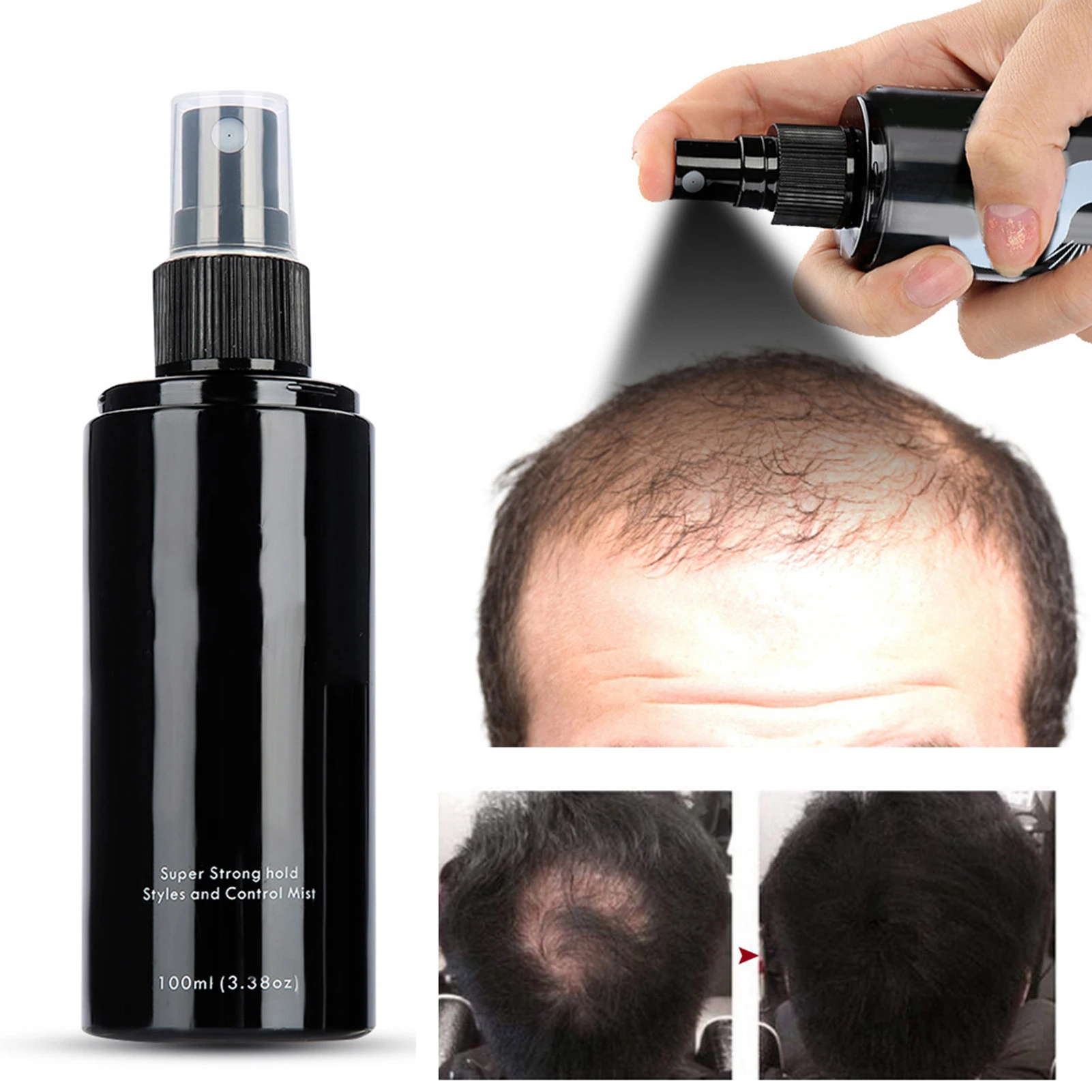 100ml-Hair-Building-Powder-Spray-Keratin-Thicker-Anti-Hair-Loss ...