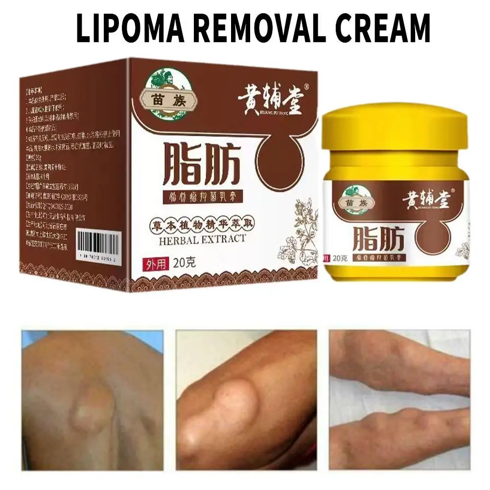 Lipoma-Removal-Cream-20g-Relief-Pain-Treat-Skin-Swelling-Lipolysis ...