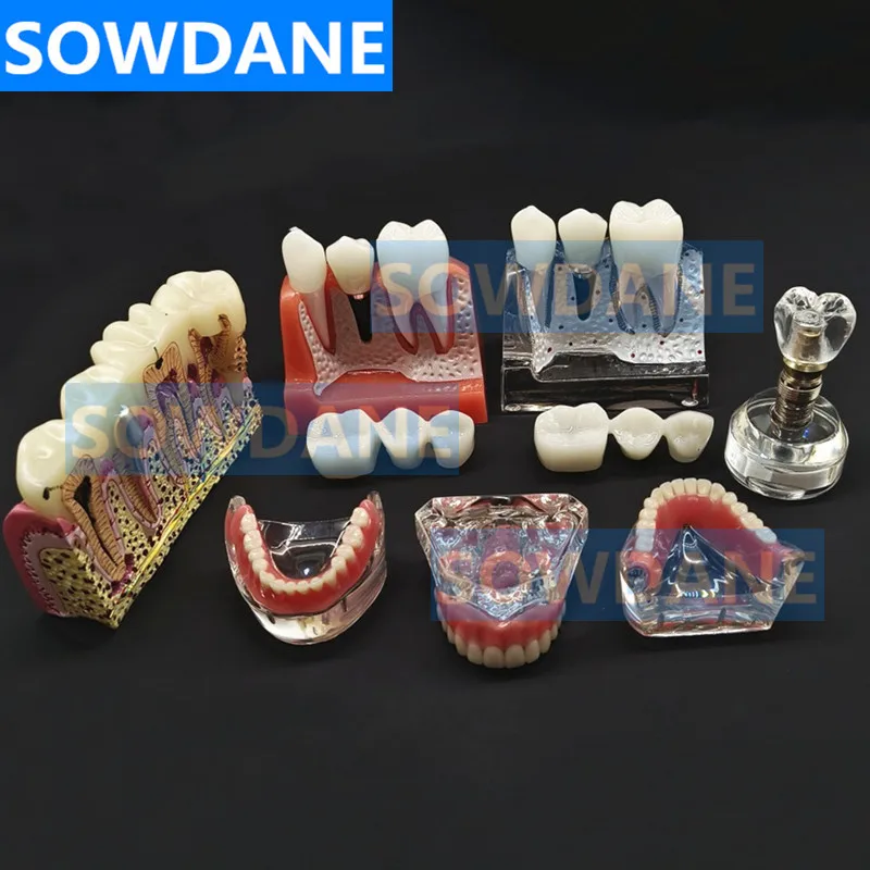 Dental-Study-Teaching-Model-Dental-Impant-Standard-Model-Removable ...