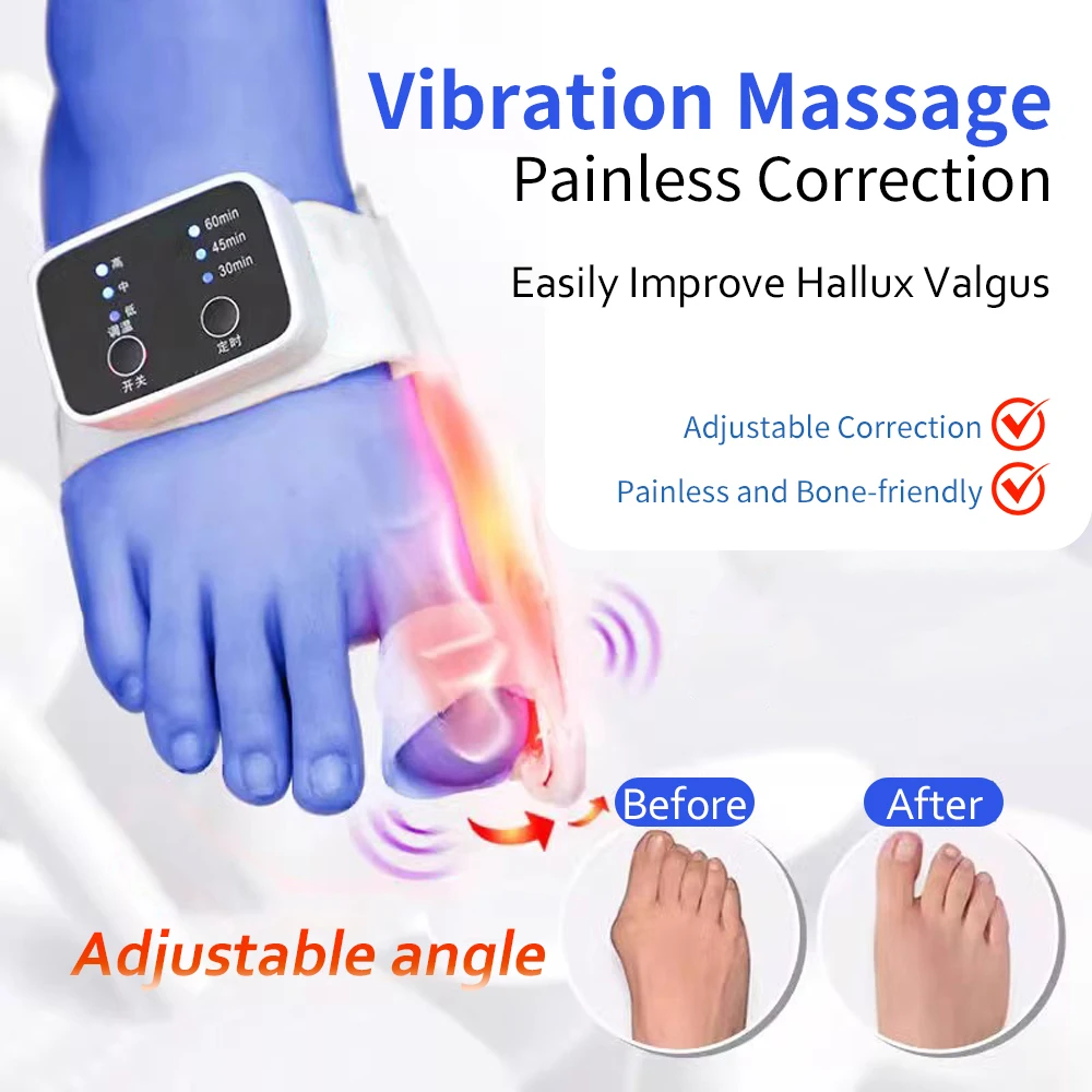 Electric Vibration Massager Bunion Corrector Unisex Foot Hallux Valgus ...