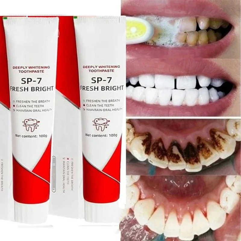 SP-7-Toothpaste-Oral-Health-Management-Deep-Probiotic-Whitening ...