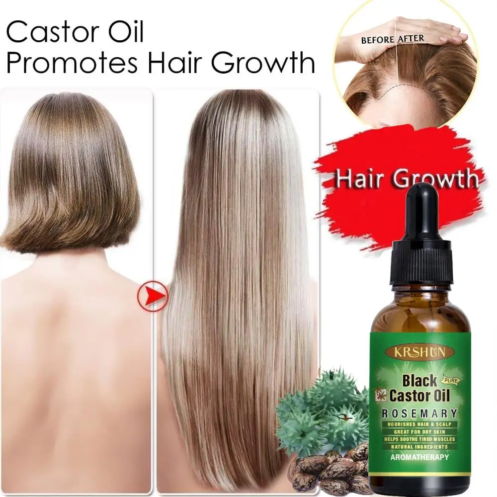 Castor Oil And Hair Growth - EMSEKFLOL.COM