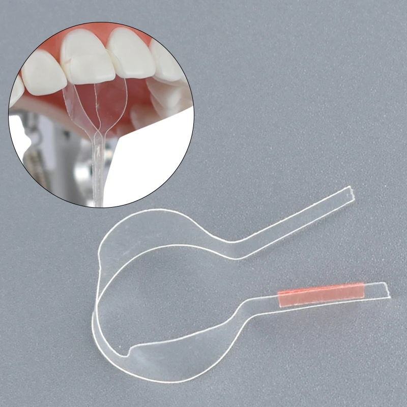 Dental-Self-Adhesive-Transparent-Sectional-Contoured-Matrix-Dental ...