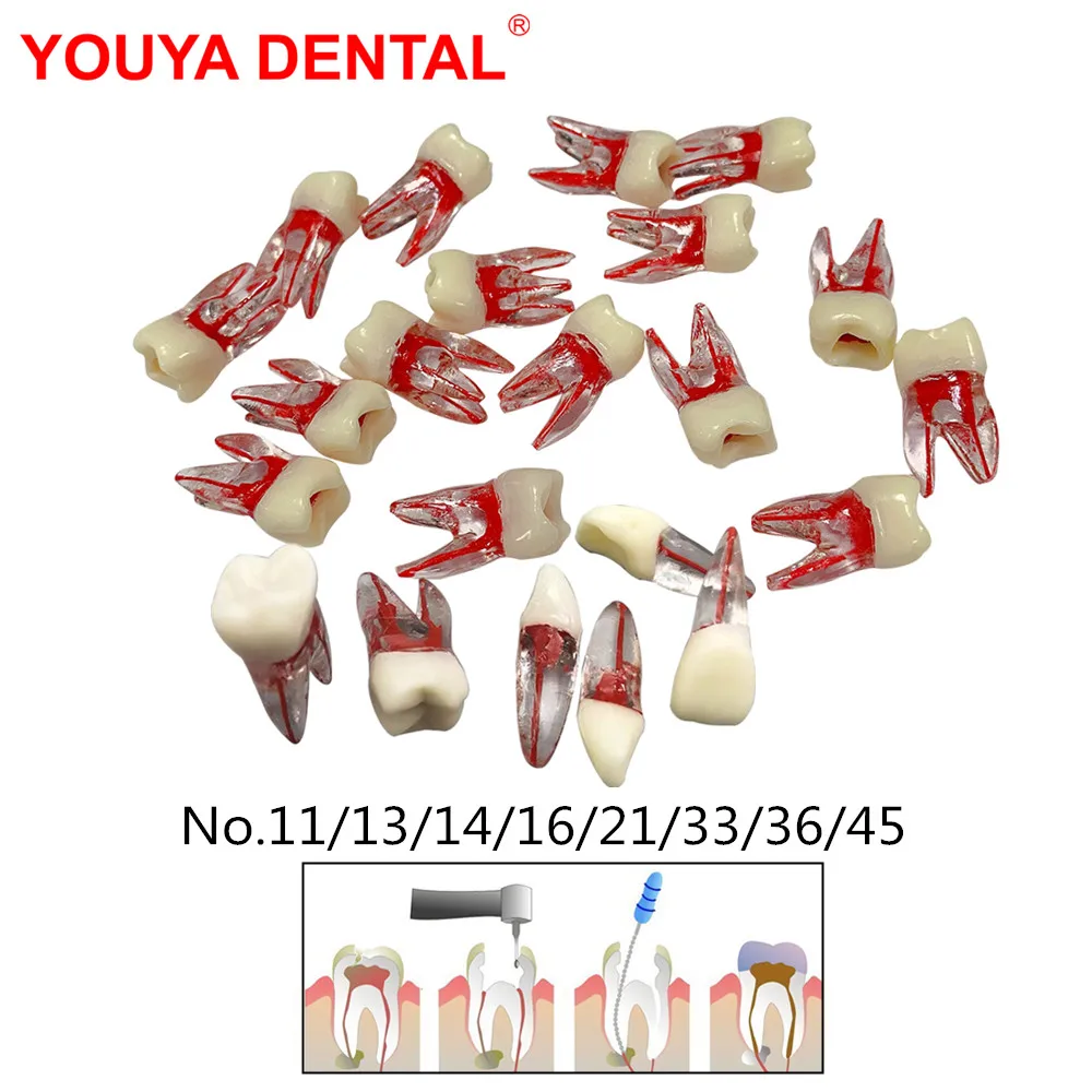 5pc Dental Endodontic Education Teaching Model Dental Cavity Model ...