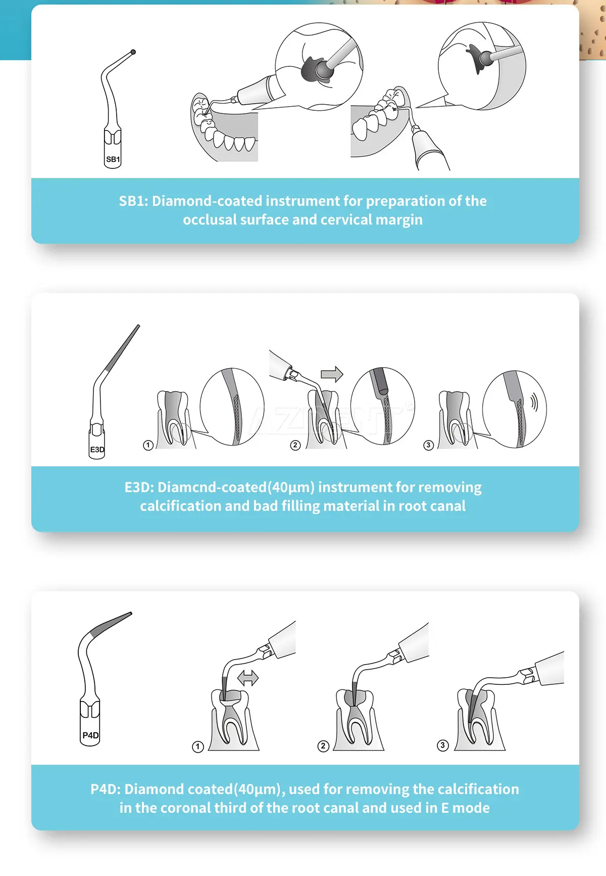 1PC Dentaire Ultrasonique de Détartreur L'échelle Parodontie Endodontie ...