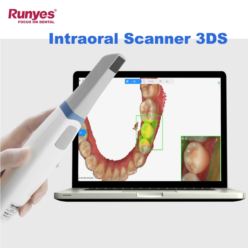 Runyes-3D-Intraoral-Digital-Dental-Impress-o-Scanner-Intraoral-Imagem-Tratamento-Ortod-ntico-3DS.jpg