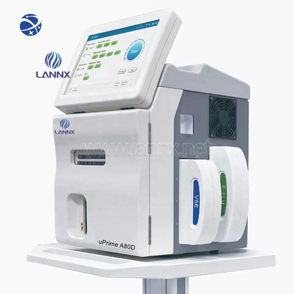 yyhc-LANNX-uPrime-A80D-Promotion-blood-gas-analyzer-portable-hospital ...