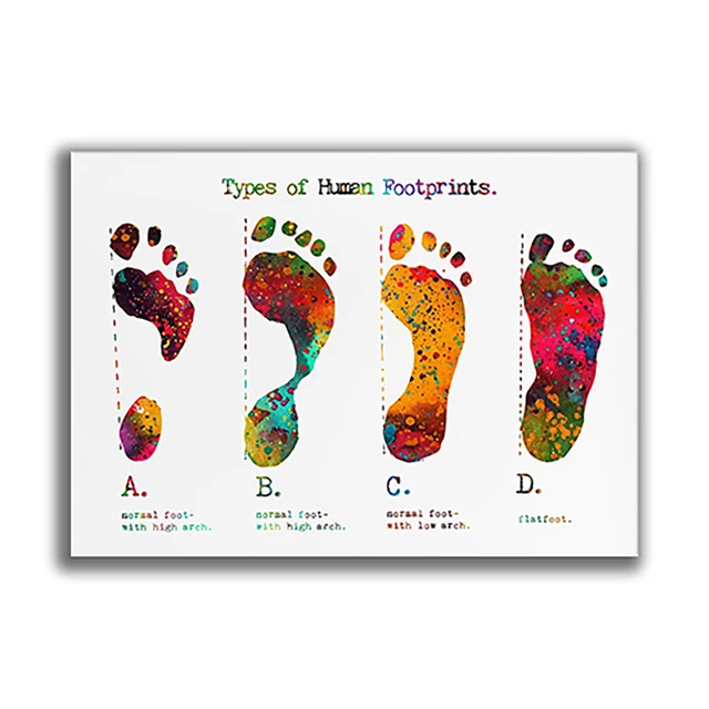 Types of Footprints Orthopedics Art Podiatry Decoration Biology Posters ...