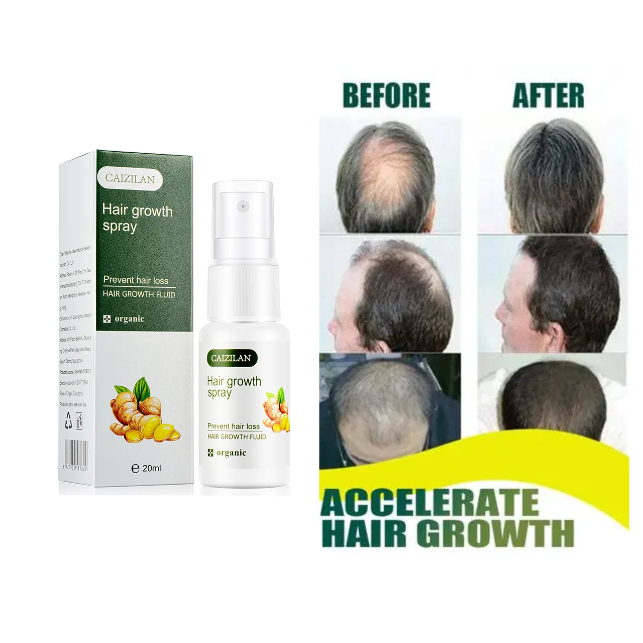 CAIZILAN 1PC Ginger Nutrient Liquid Spray Hair Growth Spray Regrowth ...