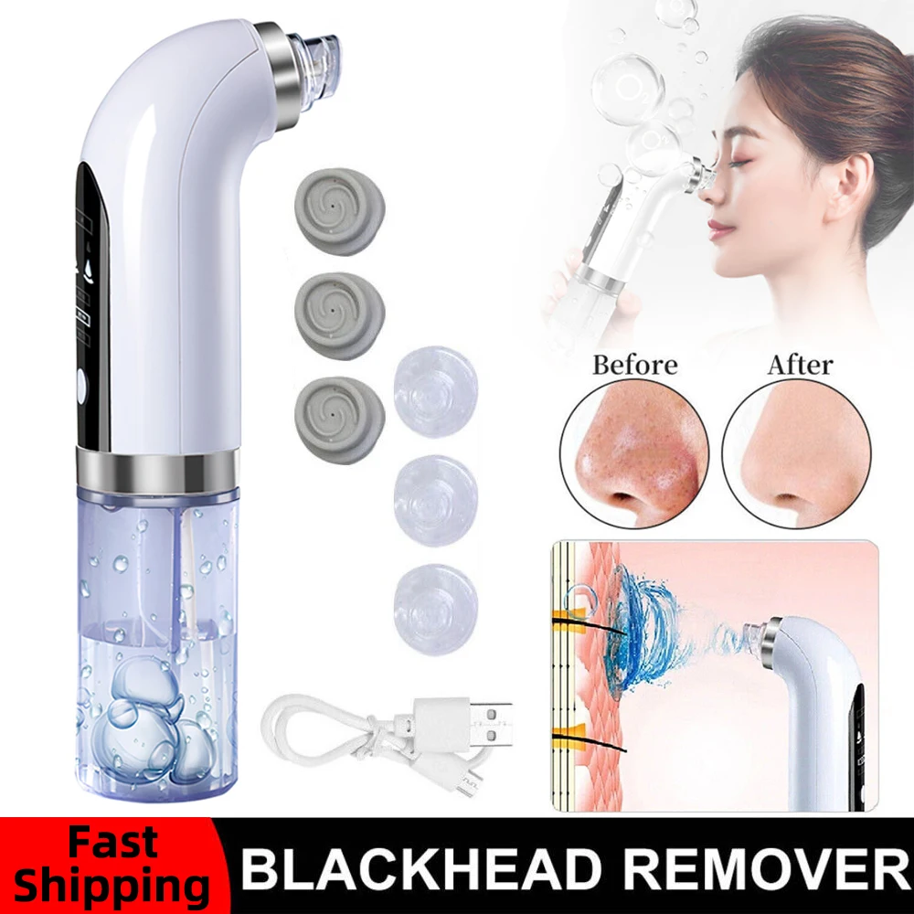 Electric-Blackhead-Remover-Vacuum-Suction-Facial-Pore-Acne-Cleaner-Dead ...