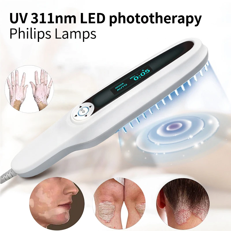 Phototherapy For Vitiligo