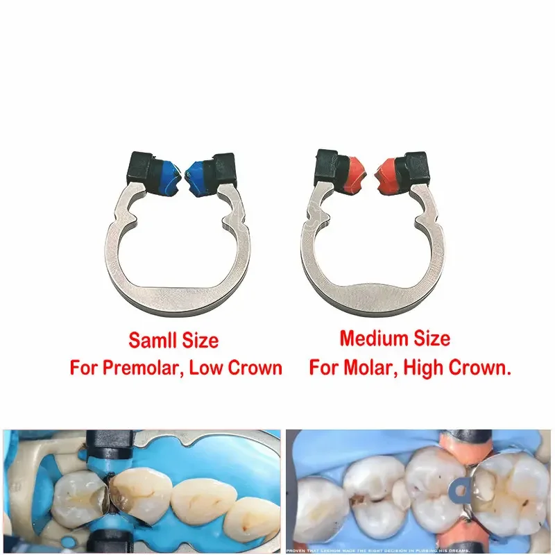 Super-Quality-Dental-NITI-Matrix-Bands-Ring-Garrison-Style-Matrix-Clamp ...