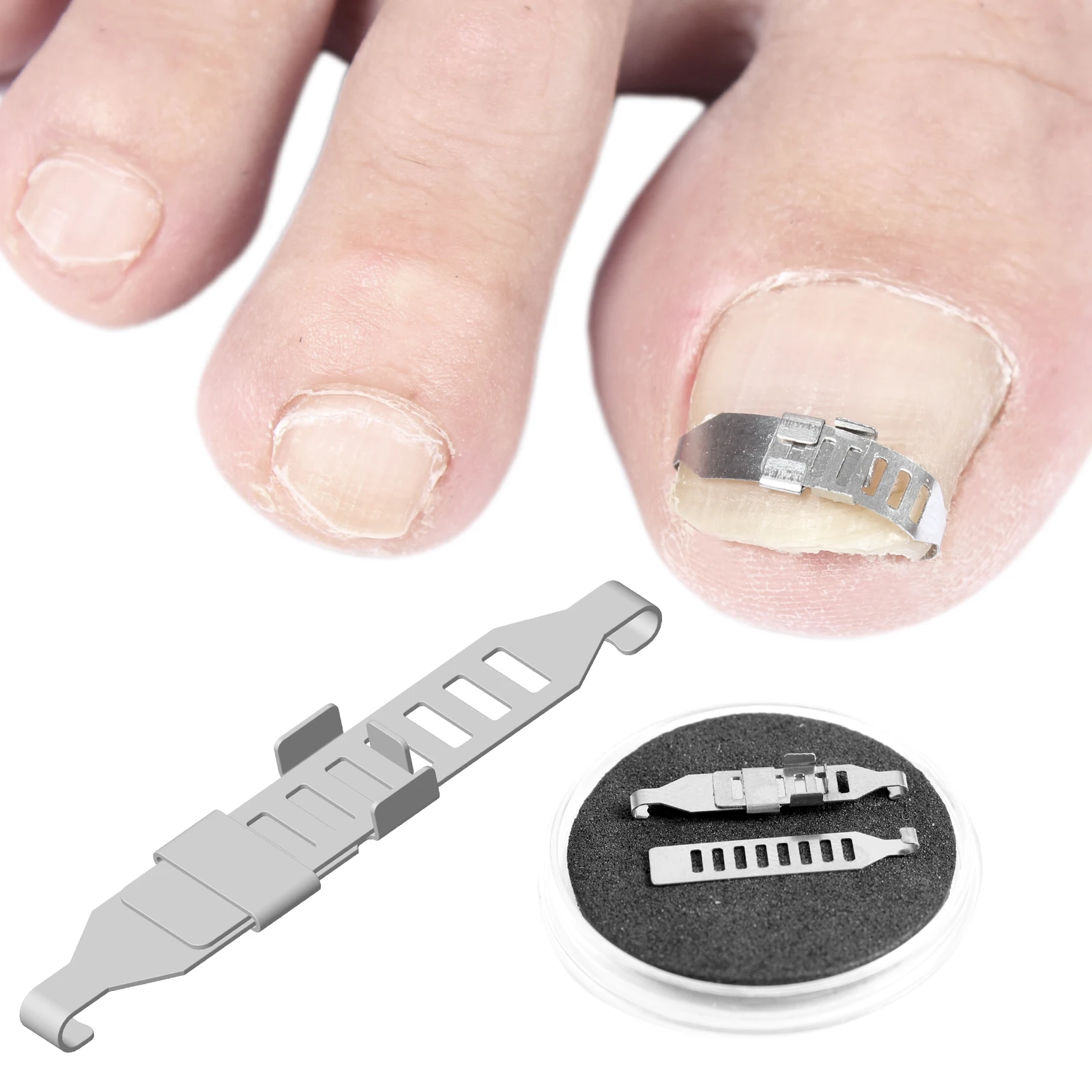 Ingrown Toenail Treatment Cotton