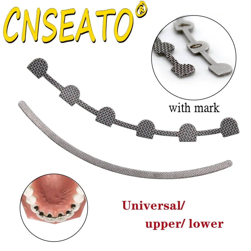 Retainer-Ortod-ntico-Lingual-Bondable-Splits-Universal-Dentistry ...