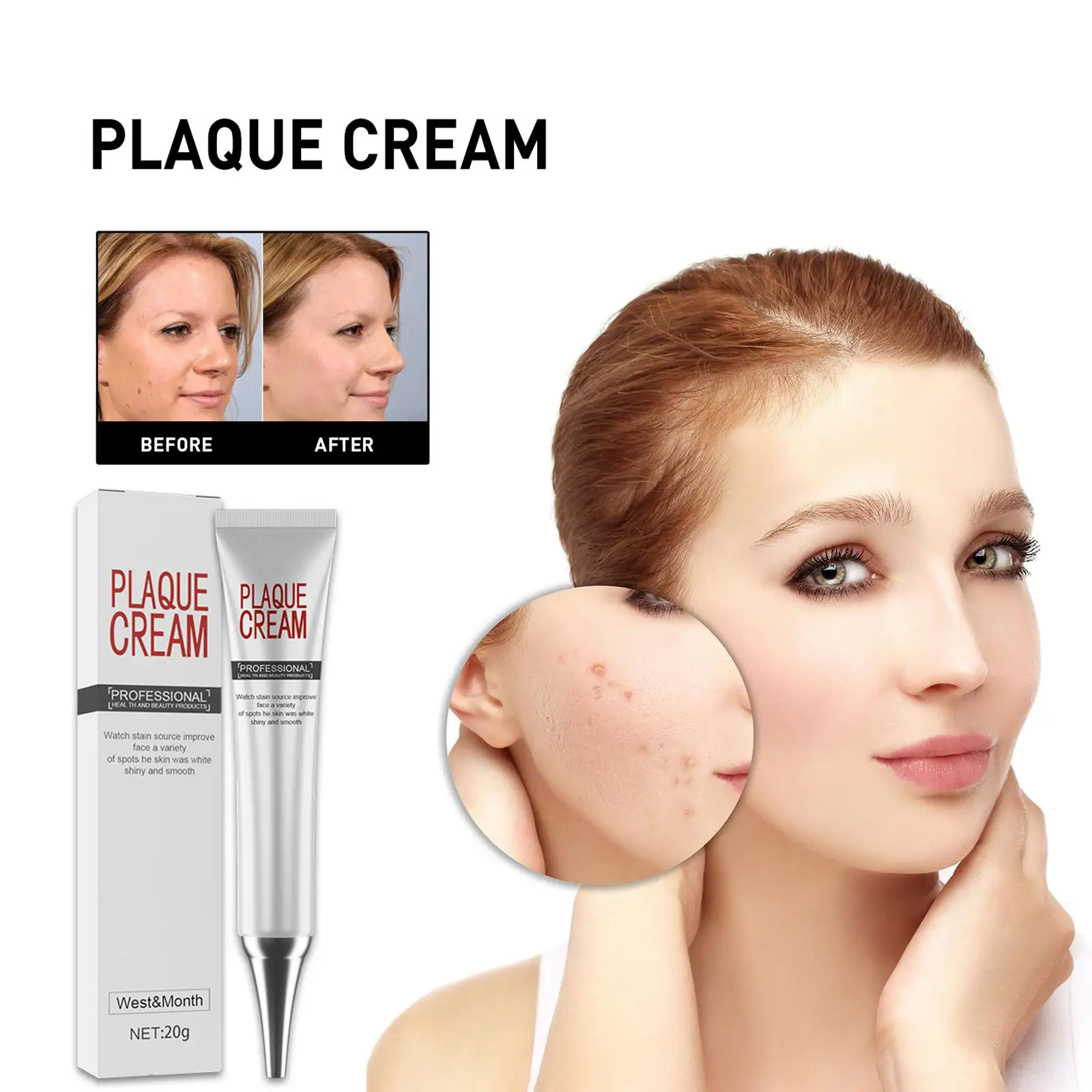 Plaque-Cream-Moisturizing-Whitening-Brighten-Cream-Plumping-Freckle ...