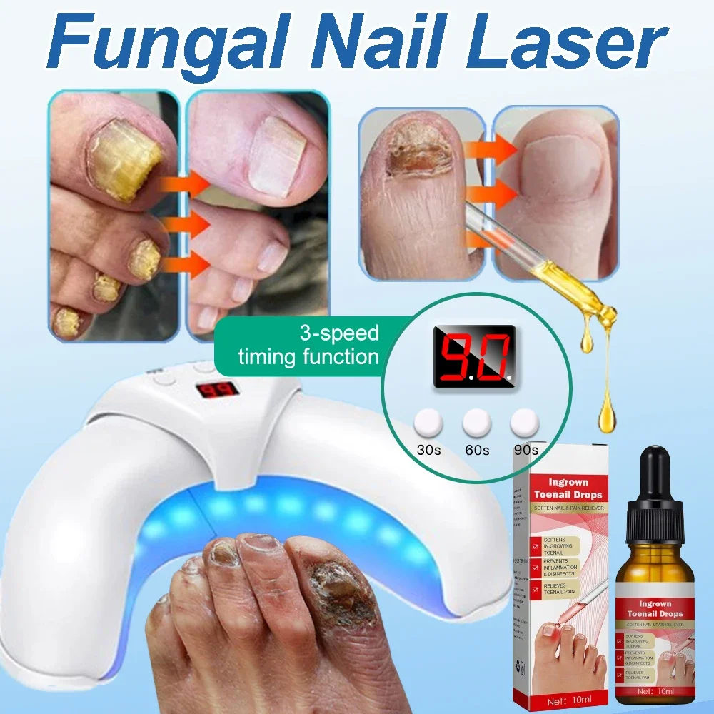 Fungal-Nail-Laser-Device-Repair-Toenail-Onychomycosis-Paronychia ...