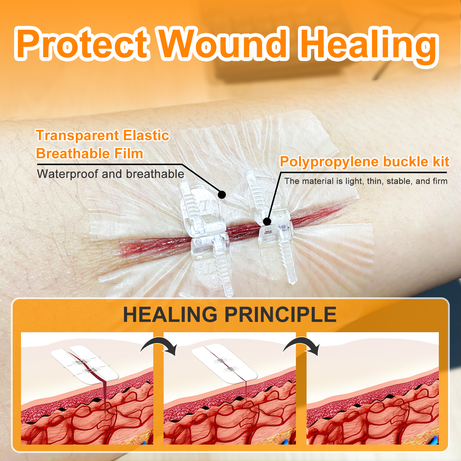 Wound Closure Device | asghedom.com