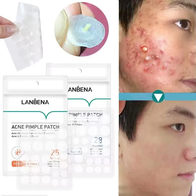 Invisible Acne Patch Anti-Pimple Waterproof Transparent Stickers ...