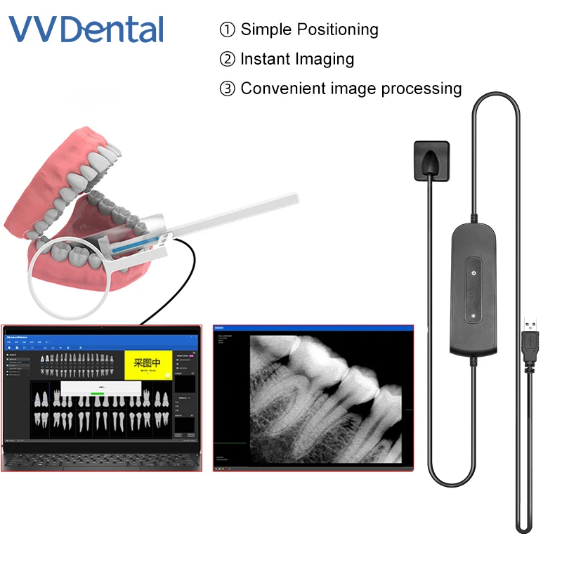 VVDental-Sensor-Dental-de-rayos-X-sistema-de-imagen-Intraoral-Digital ...