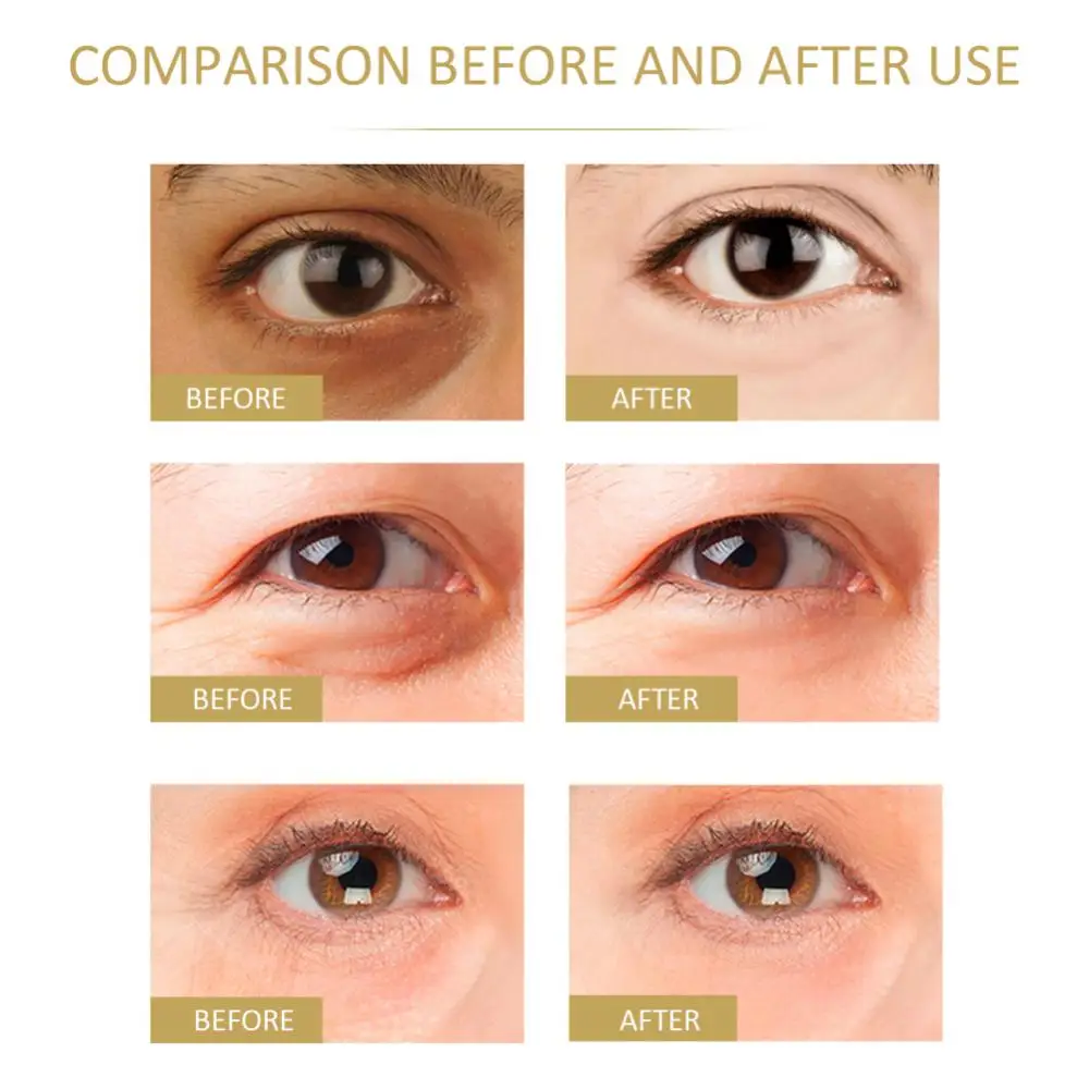 Dark Circle Defense (1 Anti-Aging Korean Formulated Eye