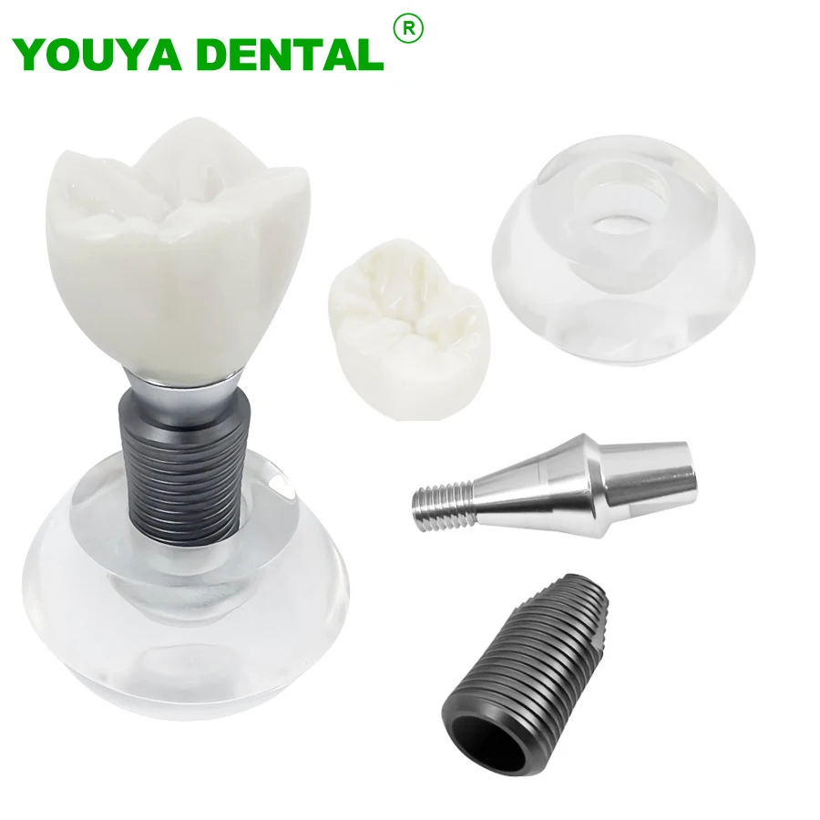 Dental-Demonstration-Model-Single-Tooth-Crystal-Implant-Model ...