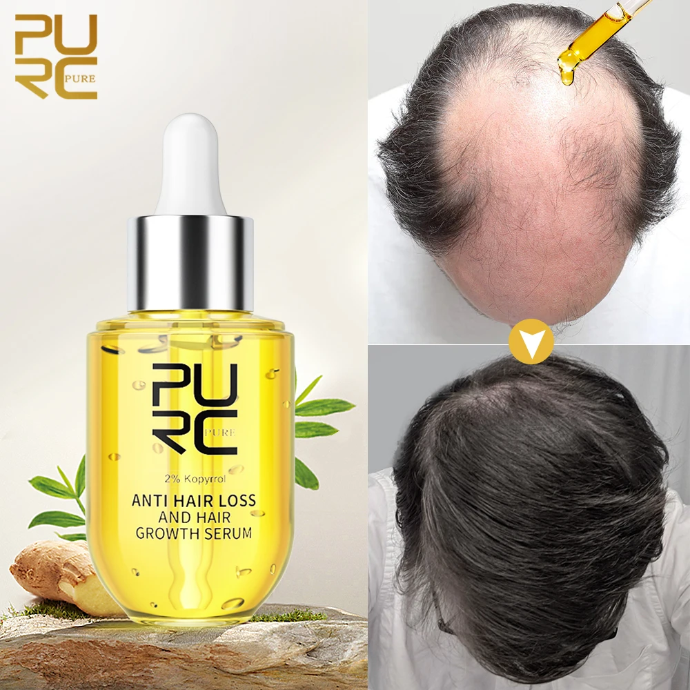 PURC-Biotin-Hair-Growth-Products-for-Men-Hair-Loss-Treatment-Serum-Ginger-Fast-Hair-Regrowth ...