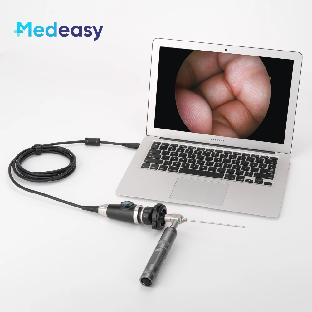 Medical USB Endoscope Camera Portable Full HD 1080P for ENT/Veterinary ...