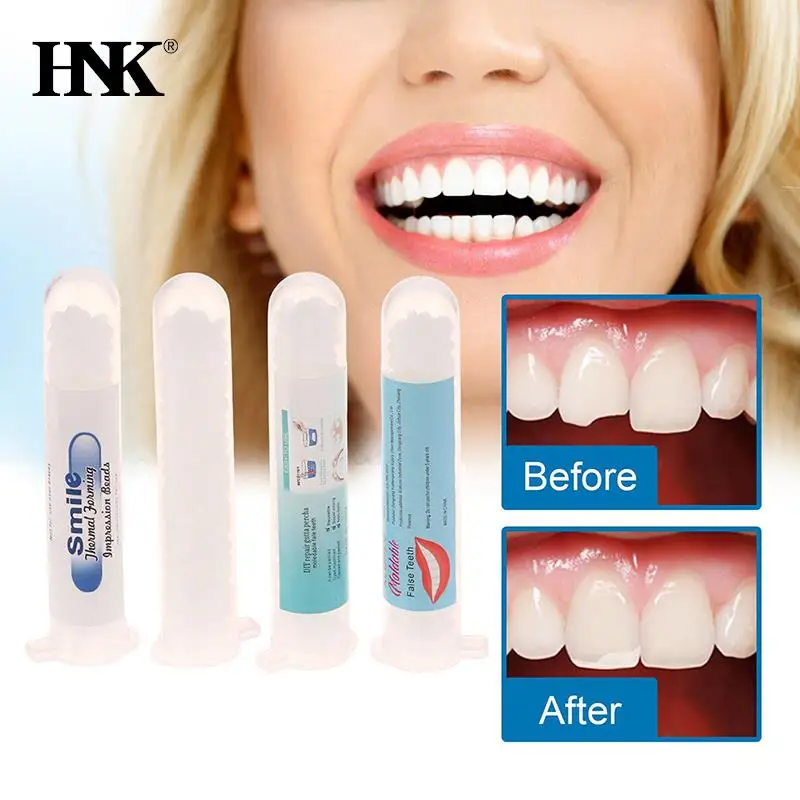 Kit-de-r-paration-temporaire-des-dents-en-r-sine-colle-solide-pour ...