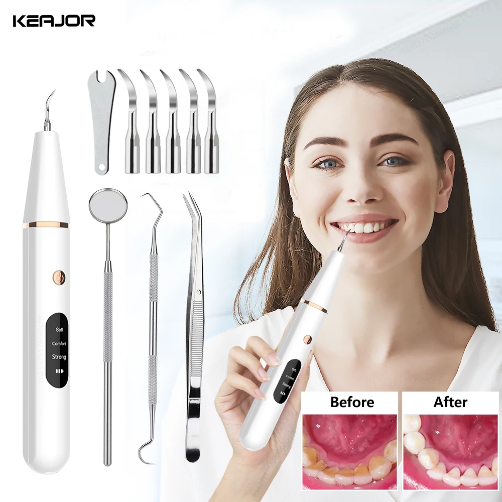Dental-Calculus-Remover-For-Teeth-Tartar-Eliminator-Electric-Dental ...