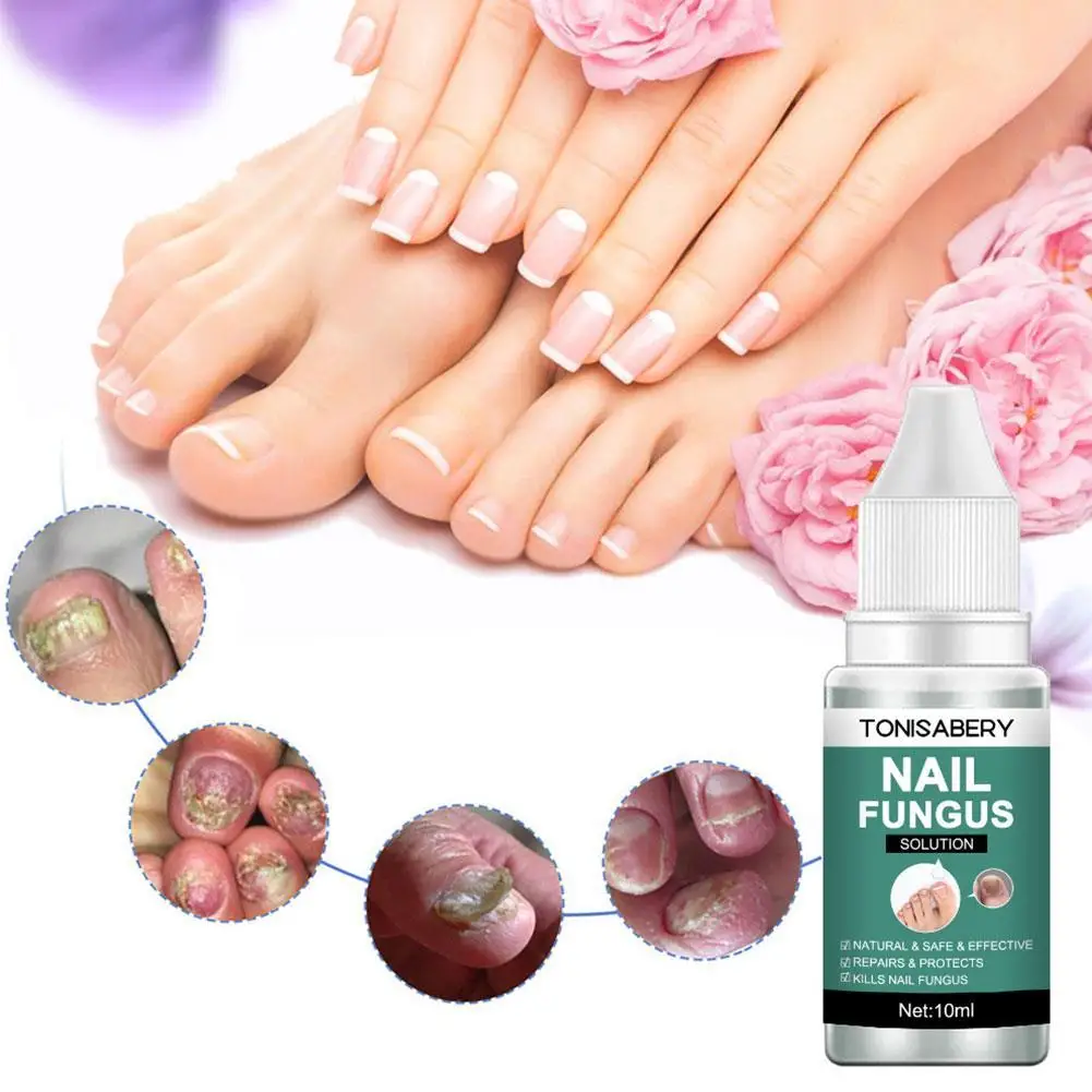 Nail-Fungal-Treatment-Feet-Care-Essence-Anti-Infection-Body-Removal ...