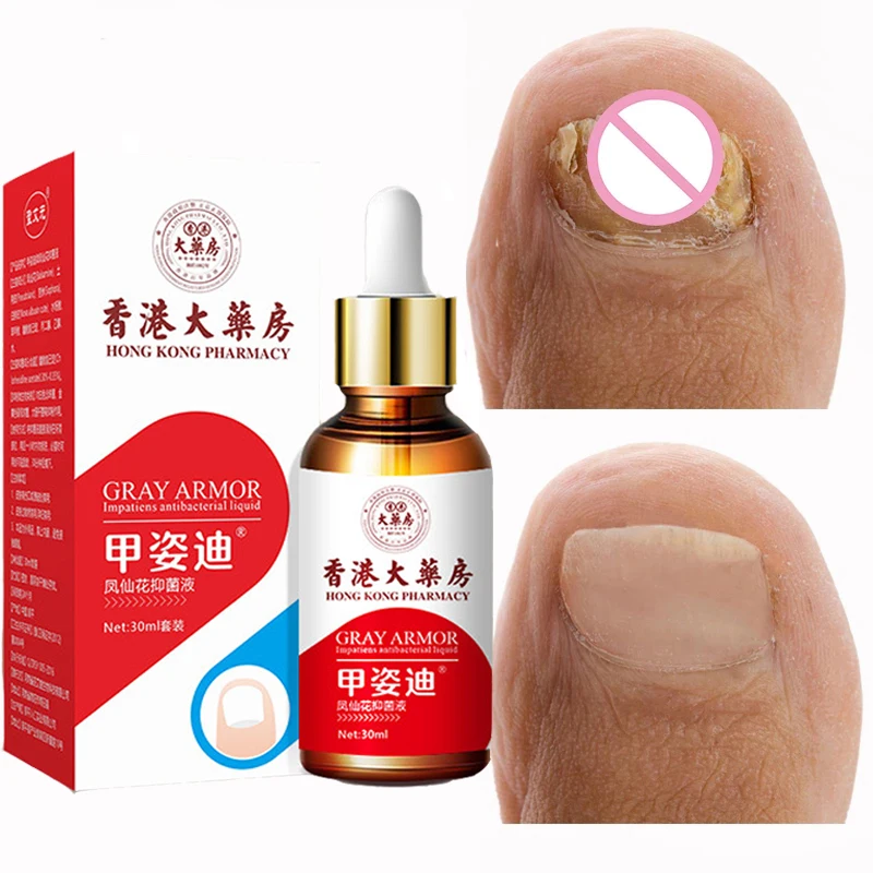 Nowy grzybicze paznokci do naprawy paznokci esencja Serum leczenie ...