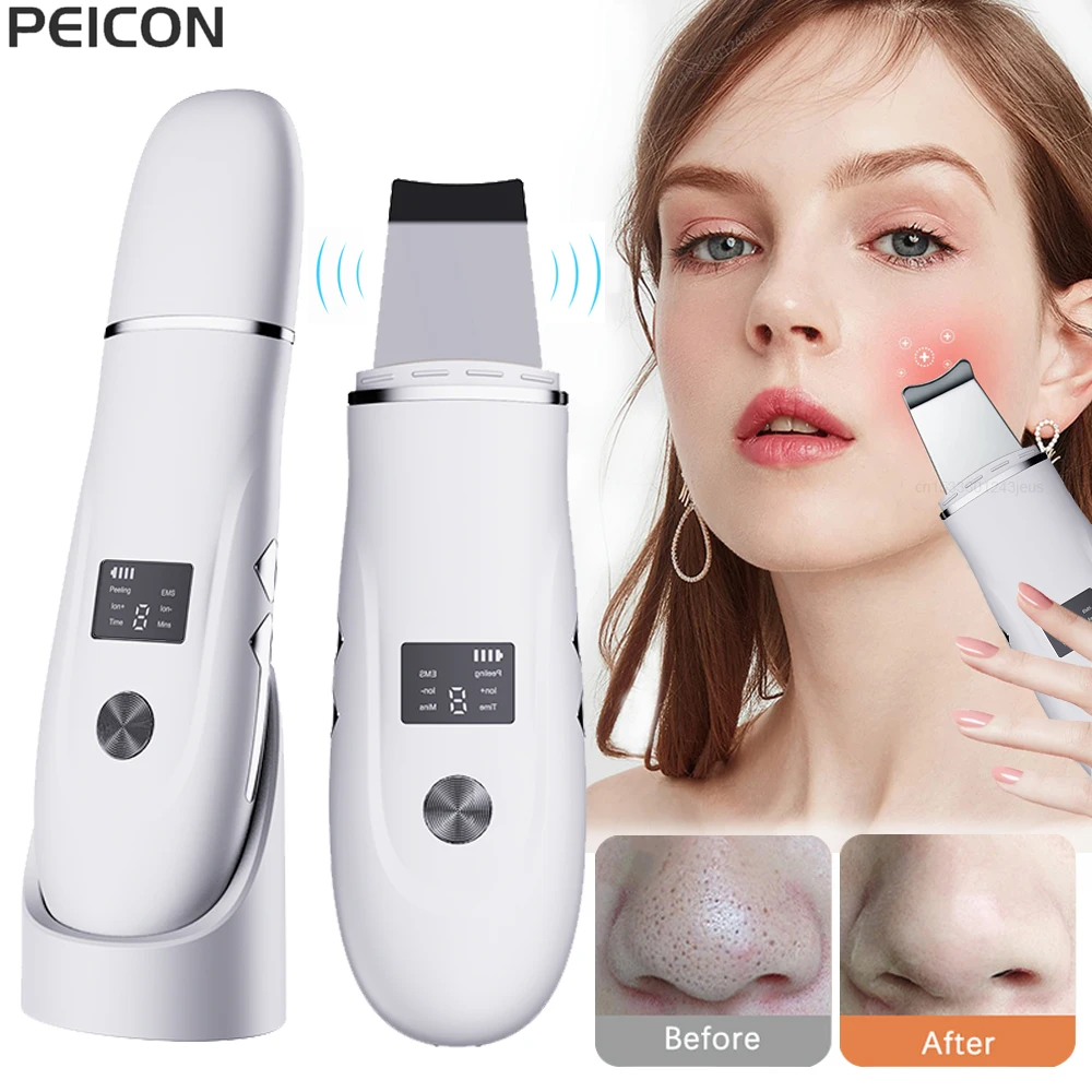 Ultrasonic-Skin-Scrubber-Blackhead-Remover-Ultrasonic-Peeling-Pore ...