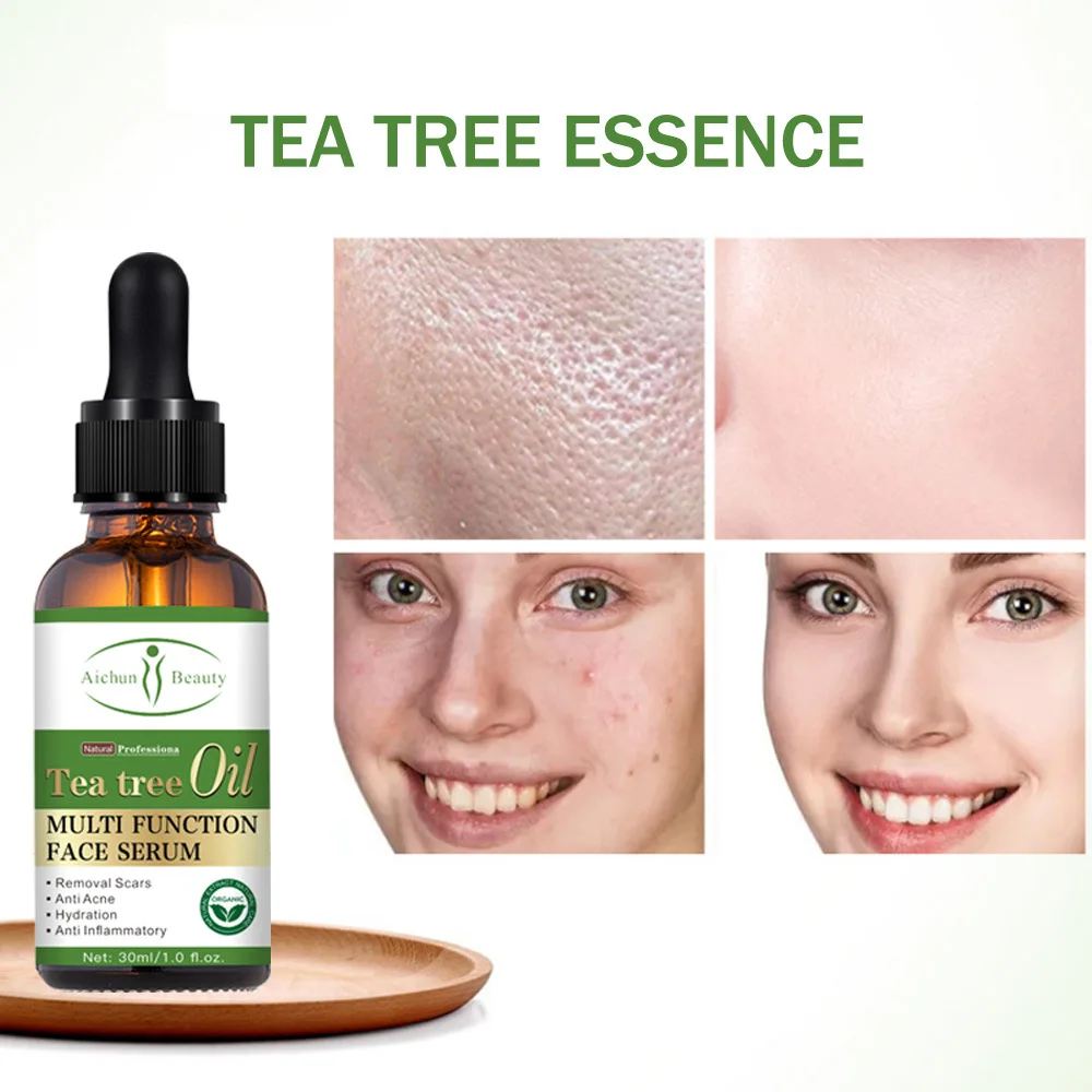 Tea Tree Oil Acne Scars