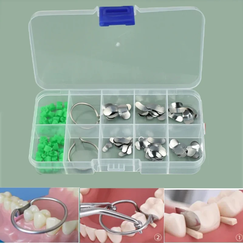 Dental-Matrix-Sectional-Contoured-Matrices-Band-Kit-Metal-Rings ...