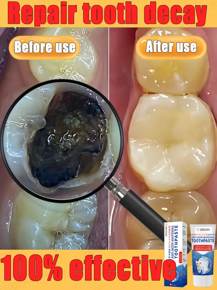 Use-natural-plant-extracts-to-repair-tooth-decay-whiten-teeth-and ...