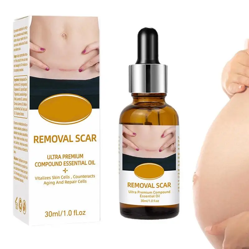 Stretch-Mark-Oil-Body-Face-Tissue-Oil-For-Scars-Stretchmarks ...
