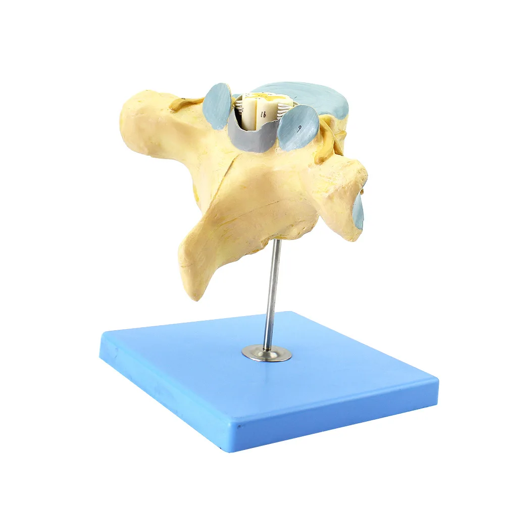 Modelo-ampliado-da-anatomia-equina-humana-do-nervo-da-cauda-do-cord-o ...