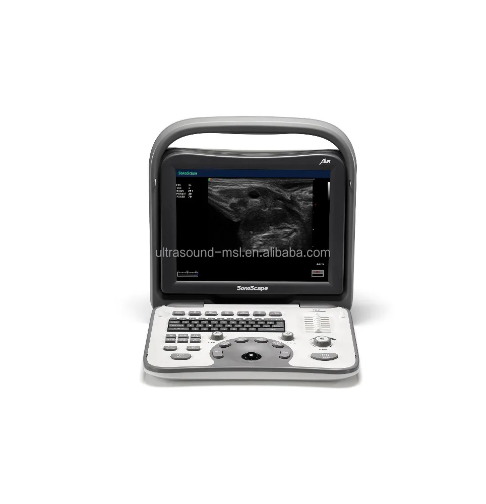 Marketing-plan-new-ultrasound-machine-A6-sonoscape-used-medical ...