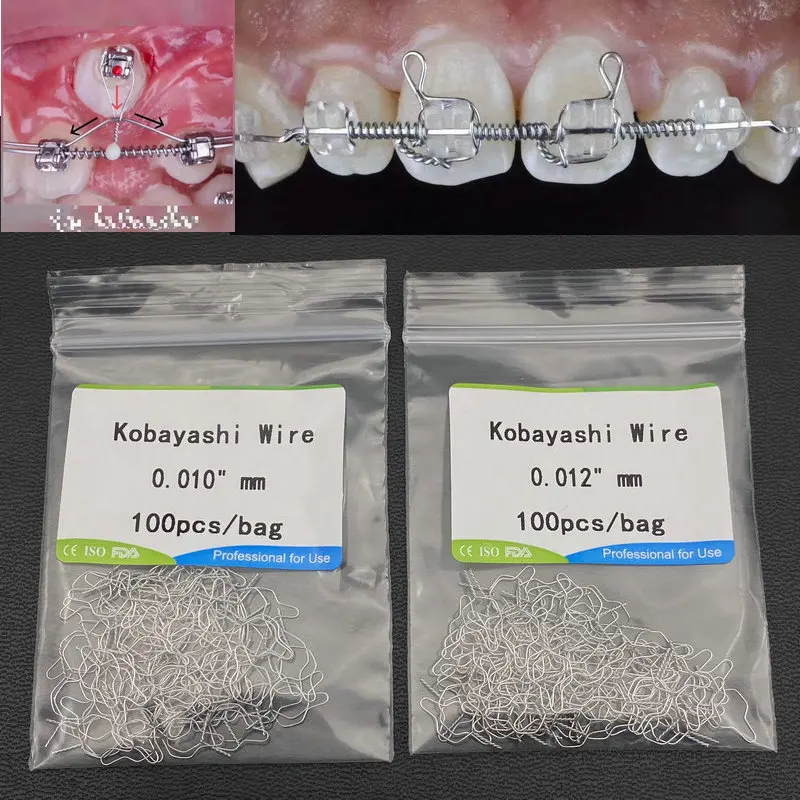 100 pièces/paquet de fil d'orthodontie dentaire Kobayashi fil d ...