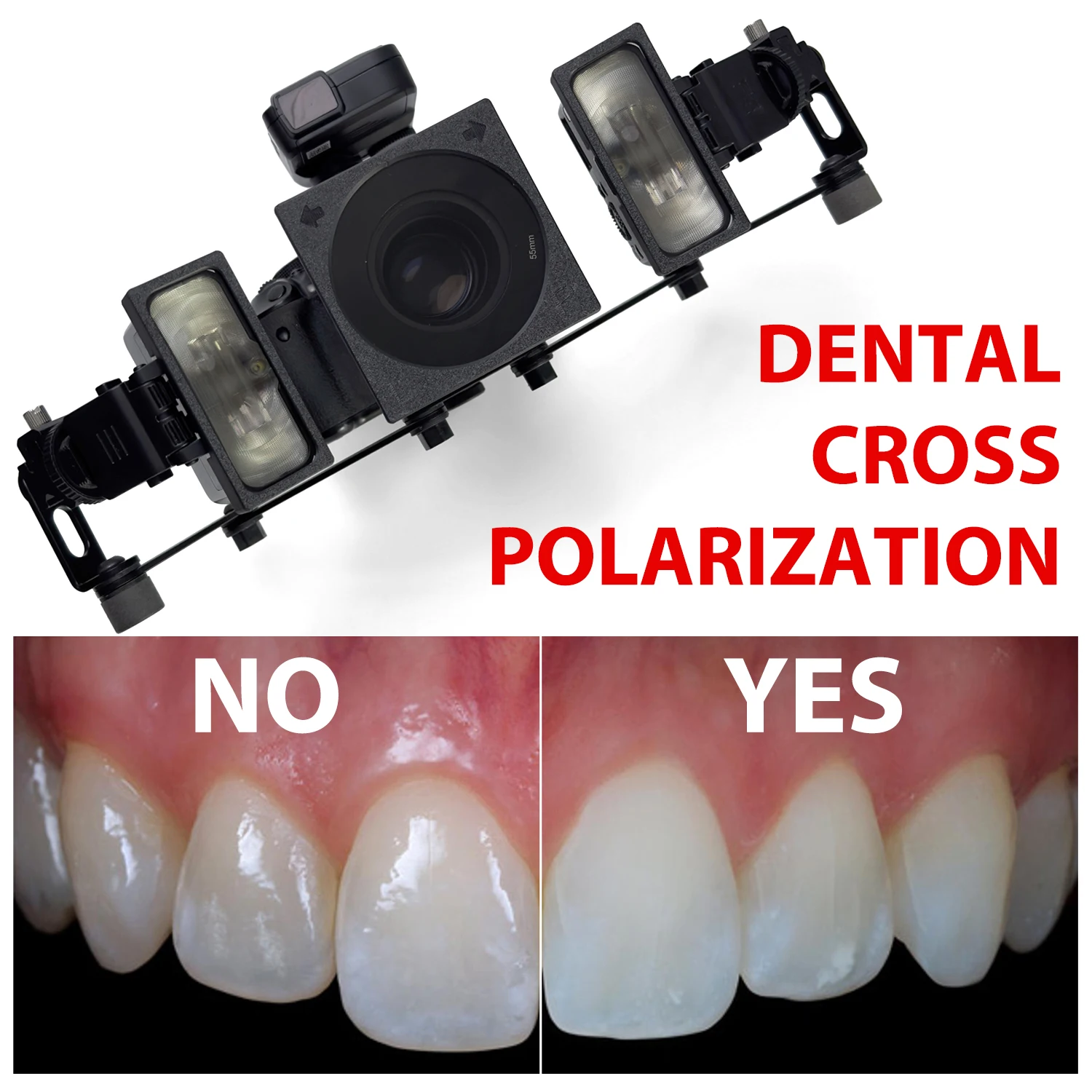 Dental-Cross-Polarization-Kit-For-Godox-MF12-Camera-Flash-No-Reflections-No-Glare-Camera-Photo ...