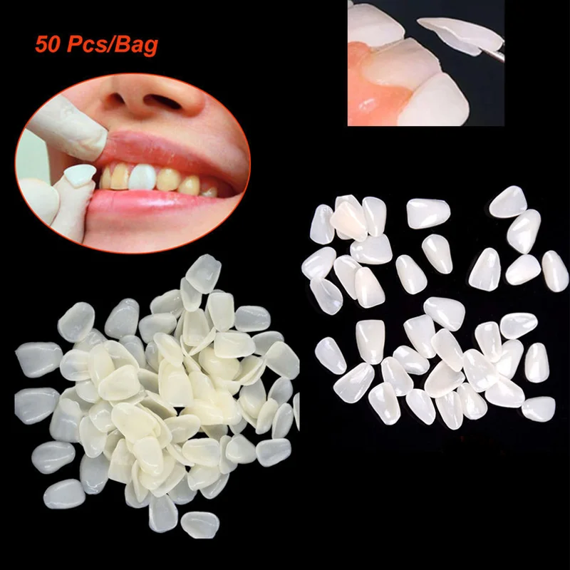Teeth-Veneers-Ultra-Thin-Temporary-Crown-Whitening-Dental-Films-Upper ...