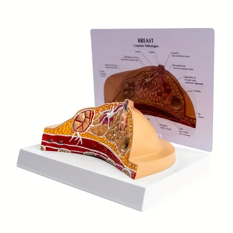 Artificial-Human-Pathological-female-Breast-Model-Medical-Disease ...