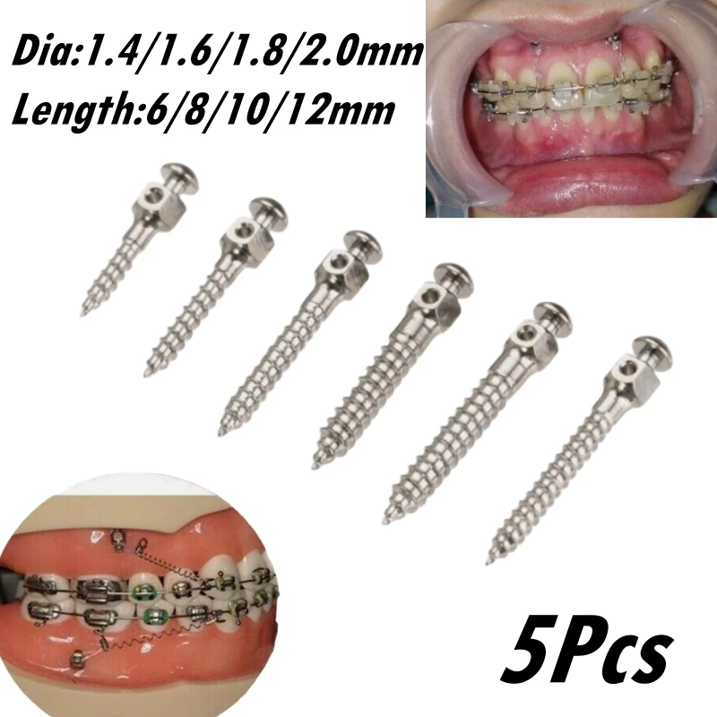5Pcs-Dental-Mini-Implant-Screws-Matching-Tool-Titanium-Alloy-Ortho ...