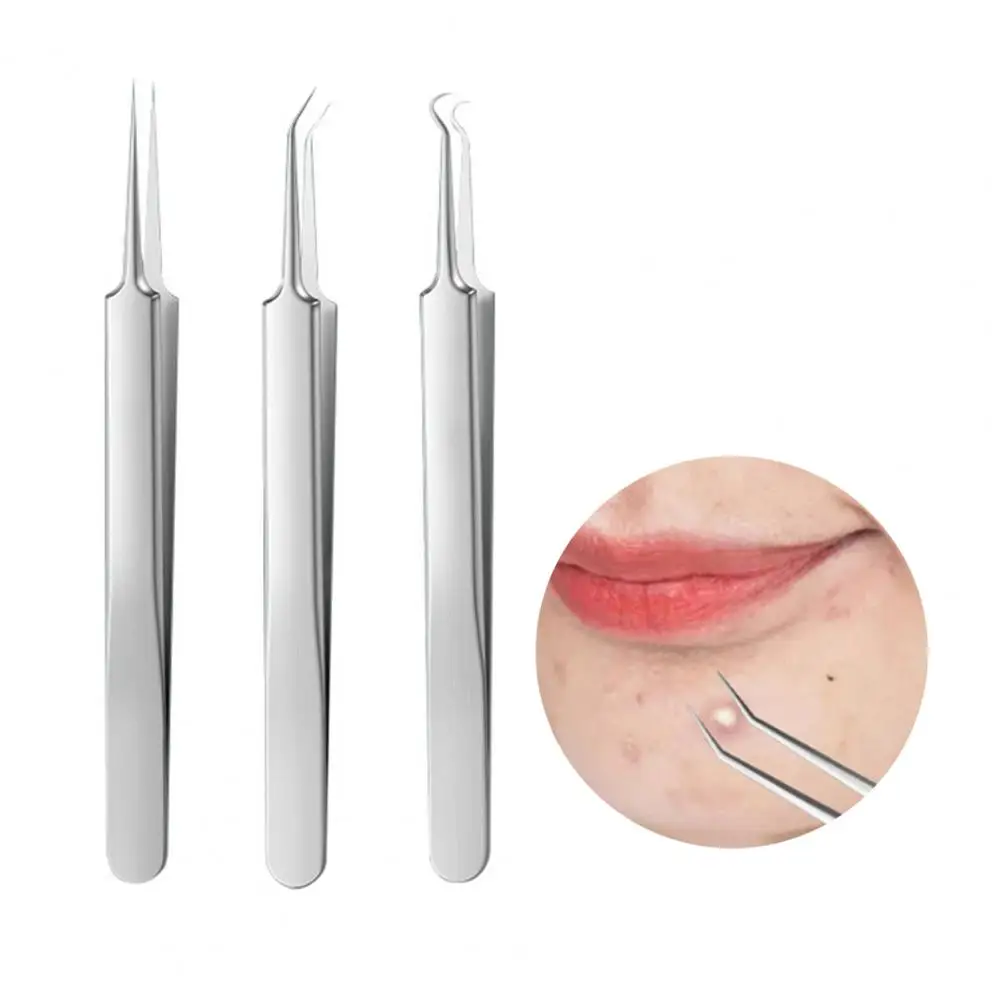 The Real Truth About Pimple Extractors: How I Finally Got Rid of My ...