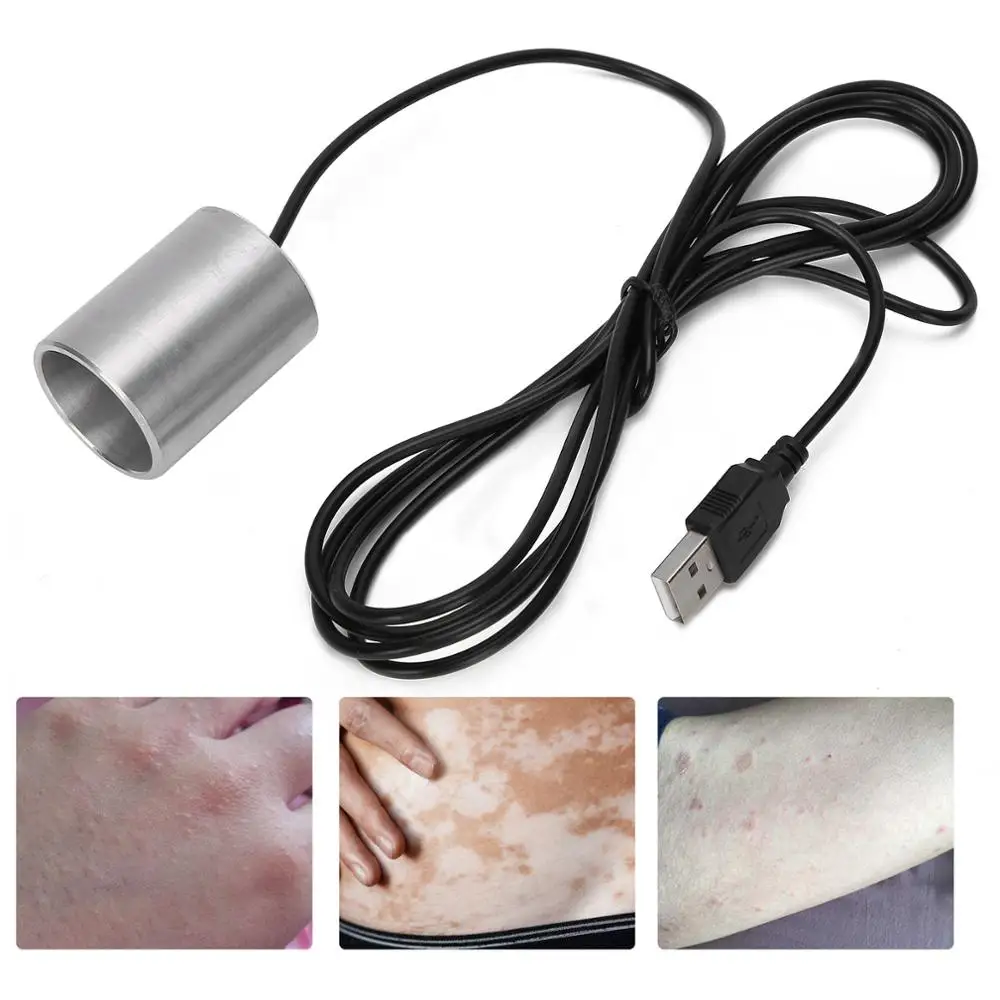 UVB-Waveform-Vitiligo-Physiotherapy-Light-Treatment-Instrument-White ...